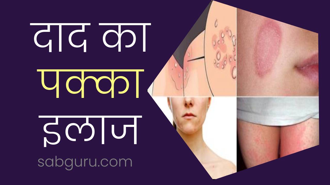 दाद का पक्का इलाज | Ayurvedic Treatment for Daad | पतंजलि दाद की दवा ...